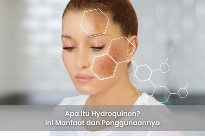 Apa Itu Hydroquinon? Ini Manfaat dan Penggunaannya-Medicastore